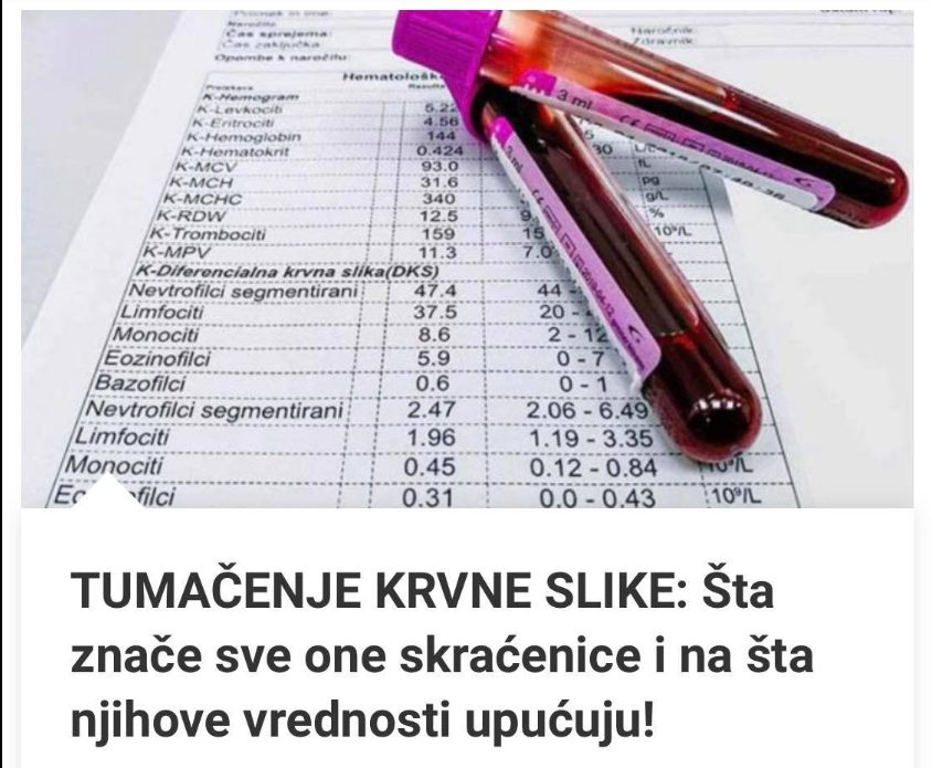 TUMAČENJE KRVNE SLIKE: Šta znače sve one skraćenice i na šta njihove vrednosti upućuju!